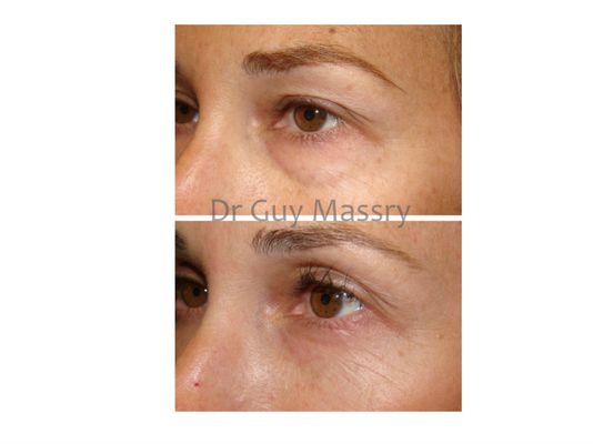 GUY MASSRY, MD - Updated December 2025 - 154 Photos & 176 Reviews - 150 ...