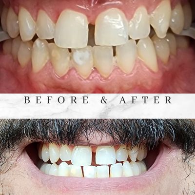 DIAMOND SMILES BY MELINDA - Updated April 2024 - Request an Appointment ...