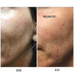 JOHN J. COREY, MD - AESTHETIC PLASTIC SURGERY - 142 Photos & 44 Reviews ...