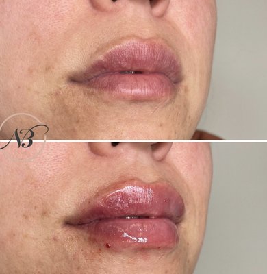 Nubella Med Spa - Updated May 2026 - 21 Photos & 37 Reviews - 11819 ...