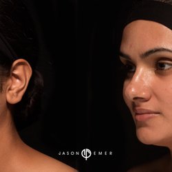 JASON EMER, MD - 914 Photos & 365 Reviews - Dermatologists - 9201 ...