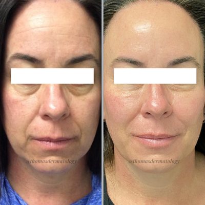 THOMAS DERMATOLOGY - Updated August 2025 - 50 Photos & 300 Reviews ...