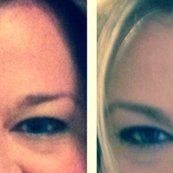 DAVID A GILPIN, MD - GILPIN FACIAL PLASTICS - Updated August 2025 ...