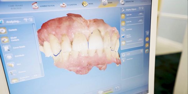 Jacobs and Thatcher Dentistry - Updated May 2026 - 25 Photos & 16 ...