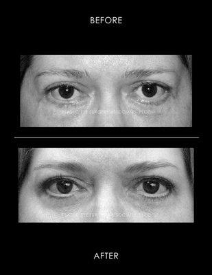 PLASTIC EYE SURGERY ASSOCIATES - Updated May 2025 - 35 Photos & 13 ...