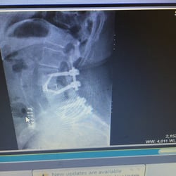 RAMIN RAISZADEH, MD - SPINE AND BRAIN INSTITUTE OF SAN DIEGO - 26 ...