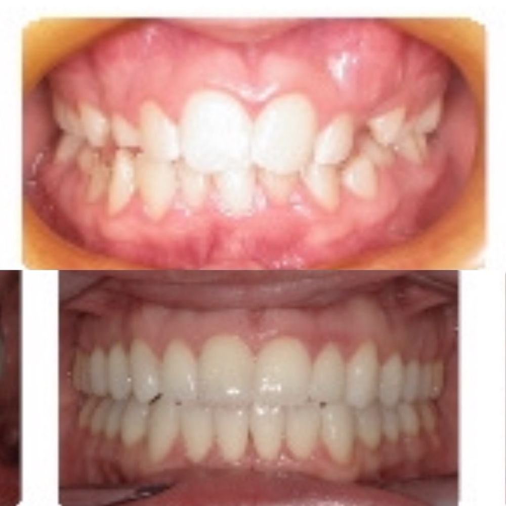 TED BENNION, DMD MS - THE BENNION SMILE - Updated December 2025 - 10 ...