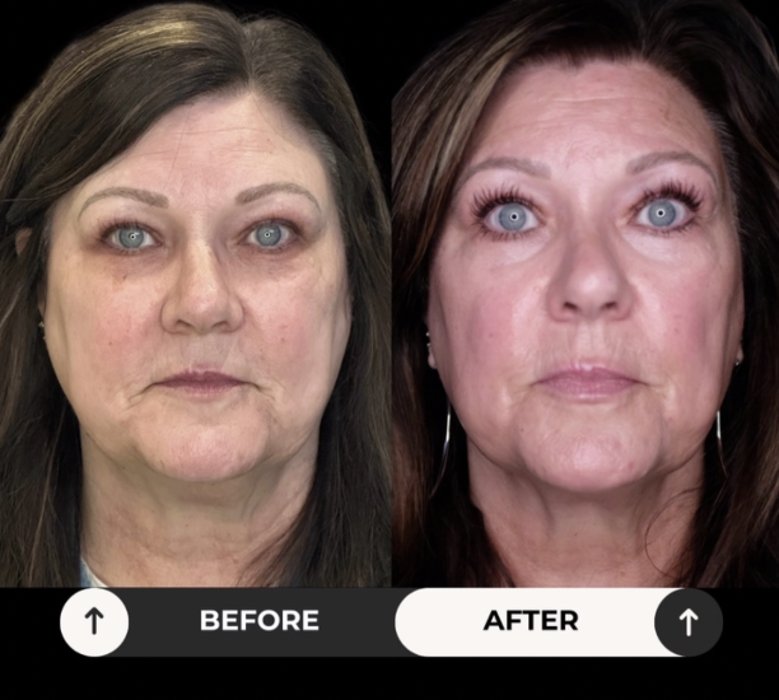MISTER BOTOX - Updated April 2025 - 11 Photos - 6050 N Central Expy ...