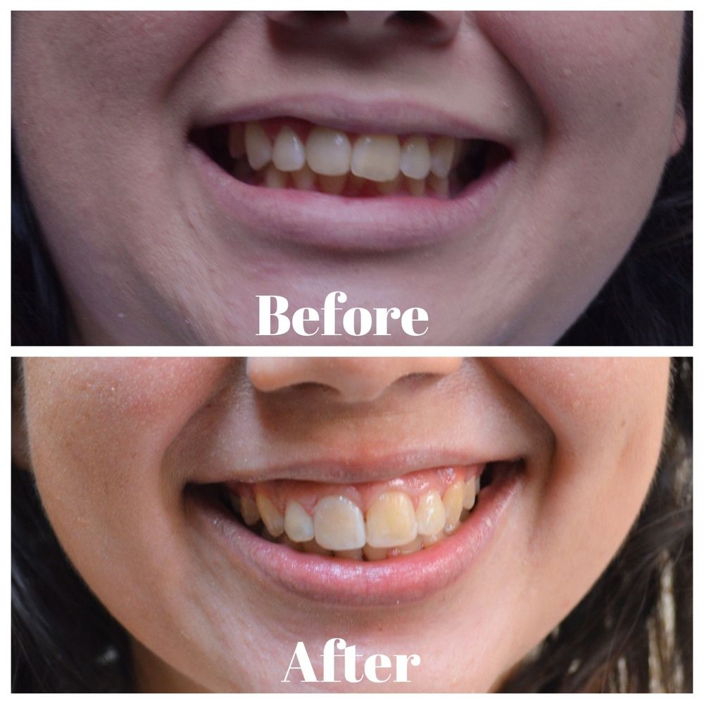 WINNER SMILE DENTAL - Updated September 2025 - 15 Photos - 1776 Old ...