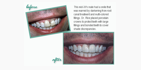 DAVID A RICE, DDS - Updated October 2025 - 38 Photos & 24 Reviews ...