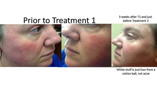 THE WOODRUFF INSTITUTE FOR DERMATOLOGY & MOHS SURGERY - Updated ...