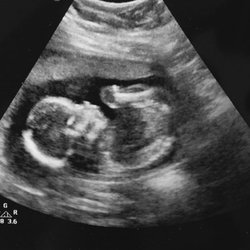 DR HUEY & DR WEPRIN OB/GYN KETTERING - 3533 Southern Blvd, Kettering ...