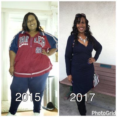 ATIF IQBAL MD - NEW LIFE SURGERY - Updated January 2026 - 56 Photos ...