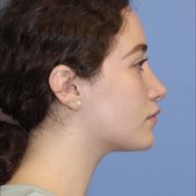 EVAN RANSOM, MD - 123 Photos & 171 Reviews - Cosmetic Surgeons - 450 ...