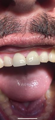 VM DENTAL - Updated October 2025 - 37 Reviews - 5515 Van Buren Blvd ...