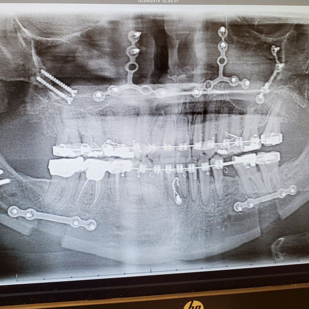 KAISER PERMANENTE - 16 Photos & 12 Reviews - 4900 W Sunset Blvd, Los ...