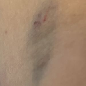 JOSHI MERCHANT, MD - Updated December 2025 - 44 Reviews - 5500 Knoll N ...