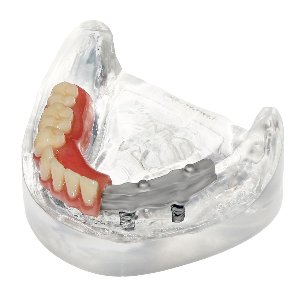 AVADENT DIGITAL DENTURES - Updated December 2025 - 15730 N 83rd Way ...