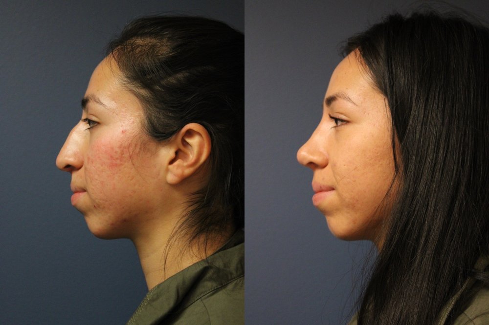 FACESFIRST COSMETIC SURGERY - Updated March 2025 - 850 E Harvard Ave ...