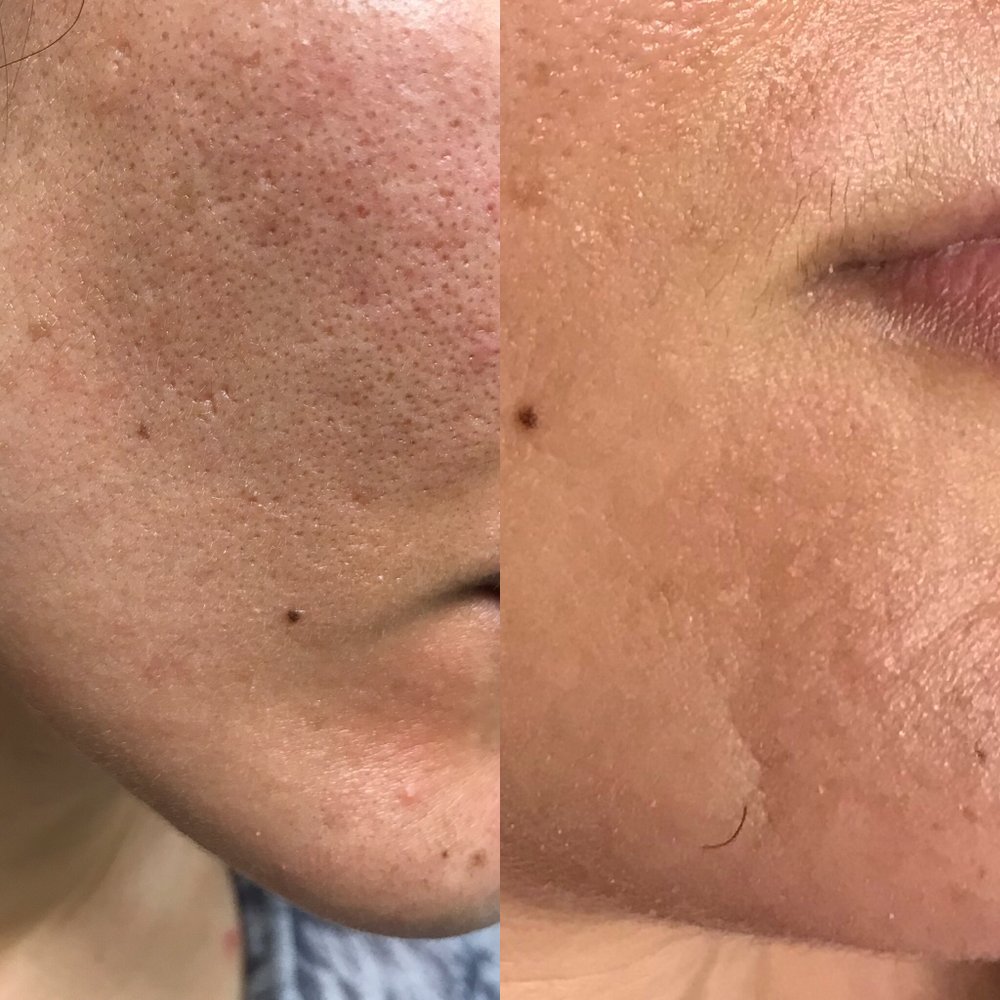 TEMPE SKIN & BODY SPA - Updated November 2024 - 86 Photos & 34 Reviews ...