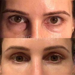 GUY MASSRY, MD - 122 Photos & 101 Reviews - Cosmetic Surgeons - 150 N ...