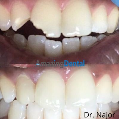 GREAT EXPRESSIONS DENTAL CENTERS - LAHSER RD - Updated October 2025 ...