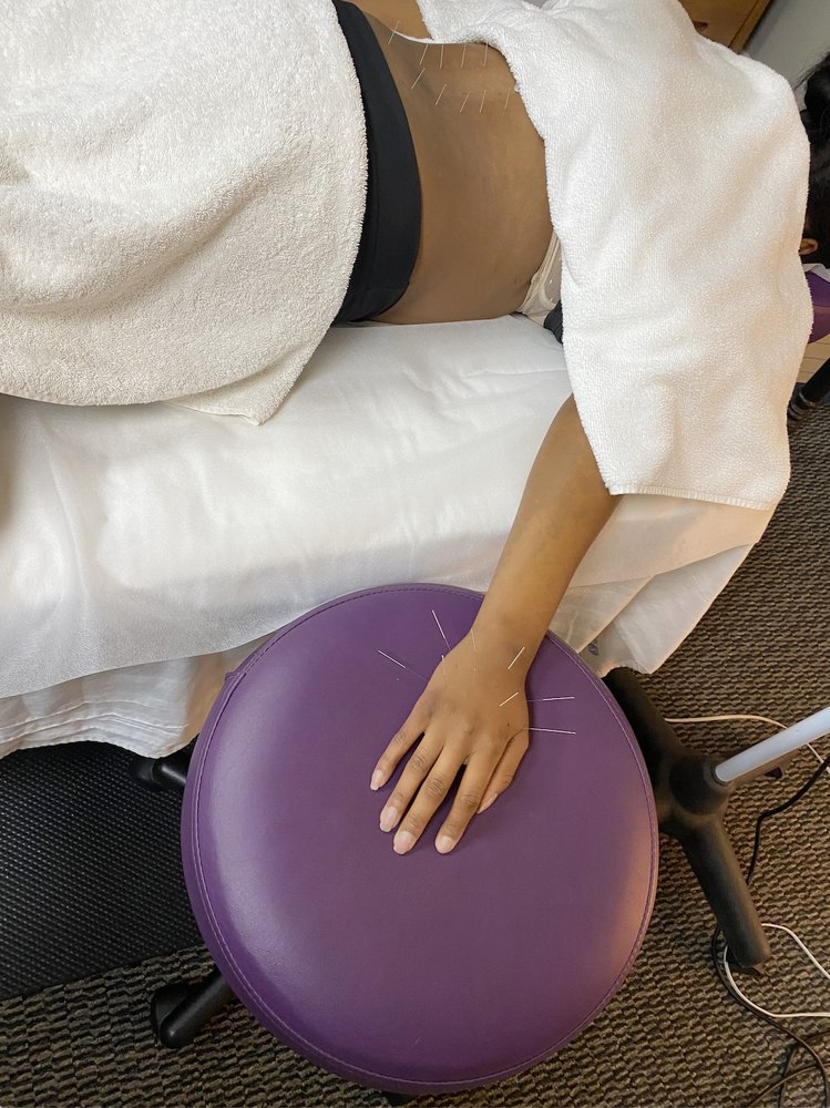 YOUTH SPRING TCM MEDICAL GROUP - Updated September 2024 - Menlo Park ...