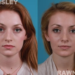 JEFFREY RAWNSLEY, MD - RAWNSLEY PLASTIC SURGERY - 61 Photos & 67 ...