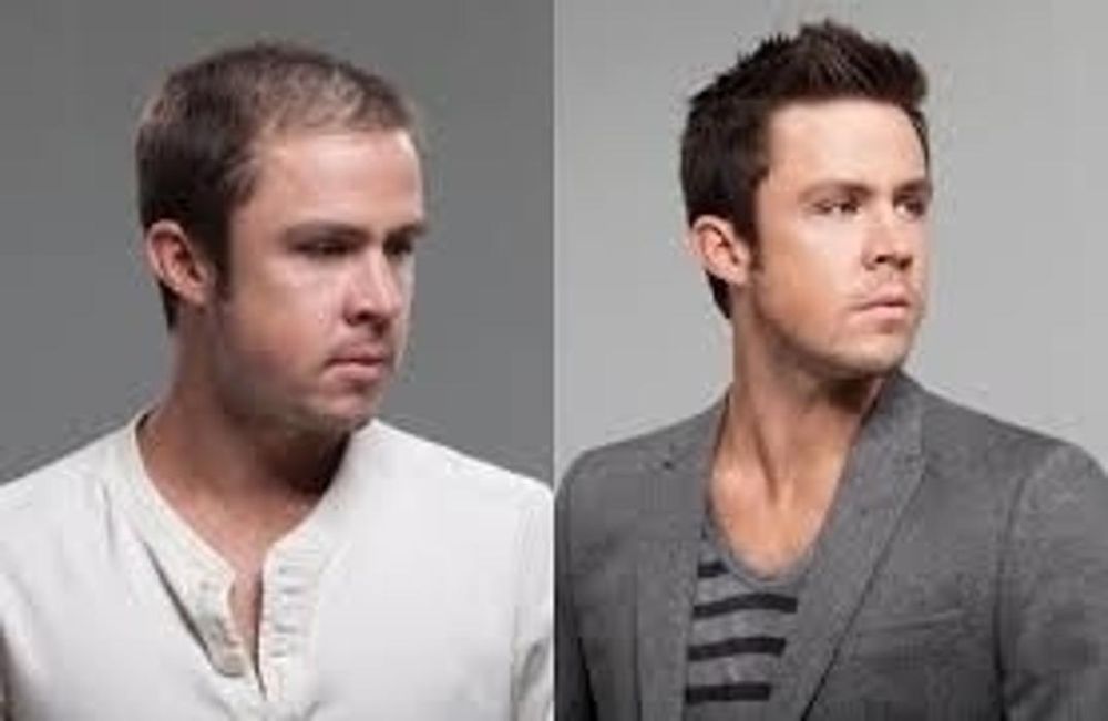 3RD DIMENSION HD HAIR SYSTEMS - 3200 Dufferin Street, North York ...