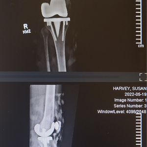 TAYLOR R DUNPHY, MD - Updated August 2025 - 38 Reviews - 22 Corporate ...