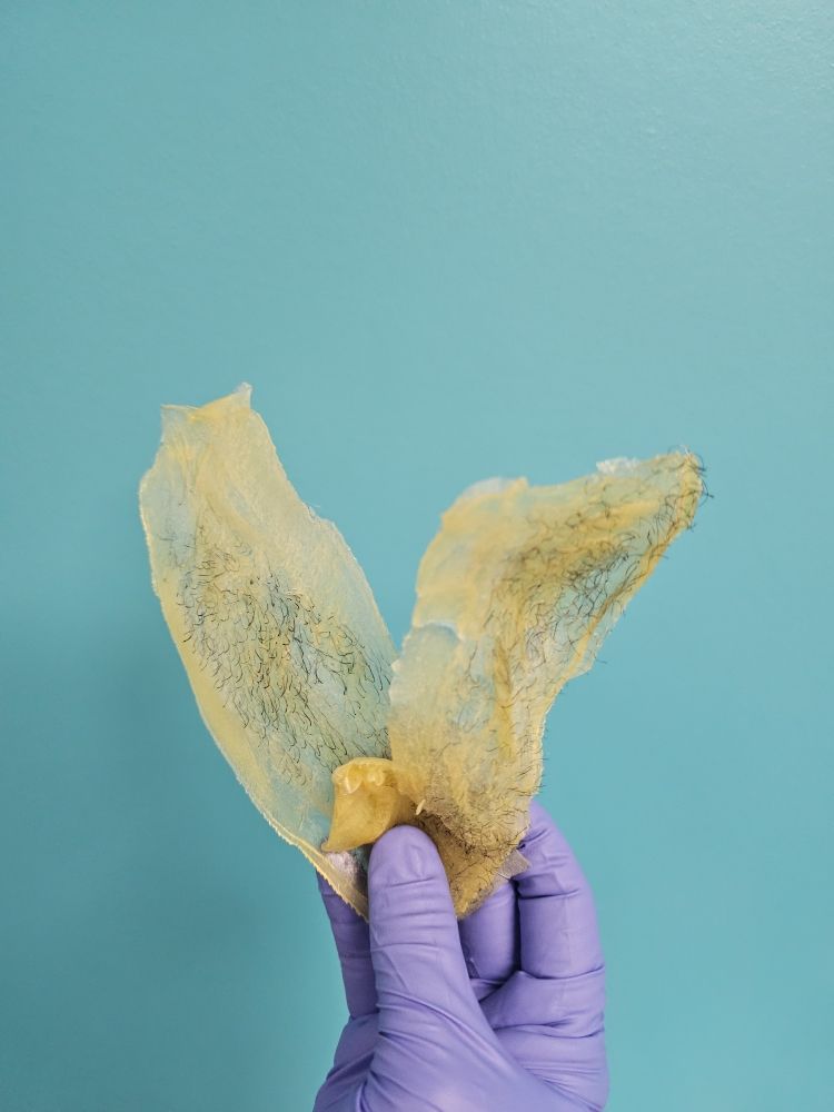 SMG AESTHETICS - Updated August 2025 - 945 Hill Ave, Wyomissing ...