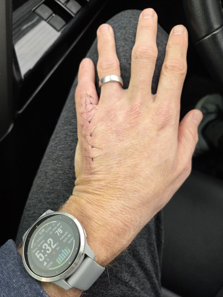 SAMIR HASAN MD - BEAUTYBLADE PLASTIC SURGERY - Updated January 2026 ...