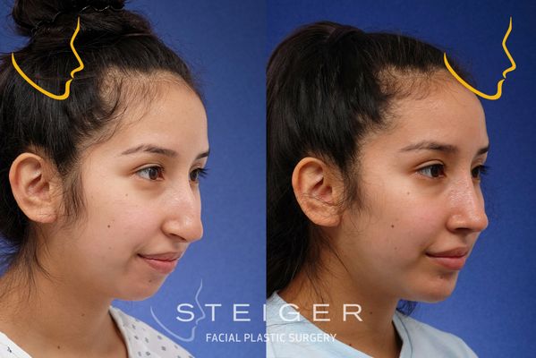STEIGER FACIAL PLASTIC SURGERY: DR. JACOB D. STEIGER - Updated December ...