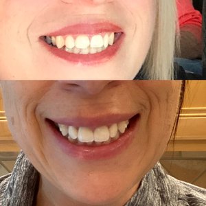 KEVIN R HADDLE, MD DDS - 26 Reviews - 426 S 3rd St, Geneva, Illinois ...