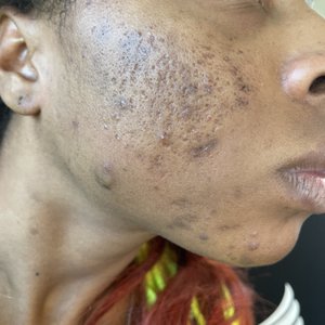 DIMITRI DERMATOLOGY - 2104 Gause Blvd W, Slidell, Louisiana - Cosmetic ...