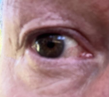 BARNET DULANEY PERKINS EYE CENTER - Updated December 2025 - 19 Photos ...