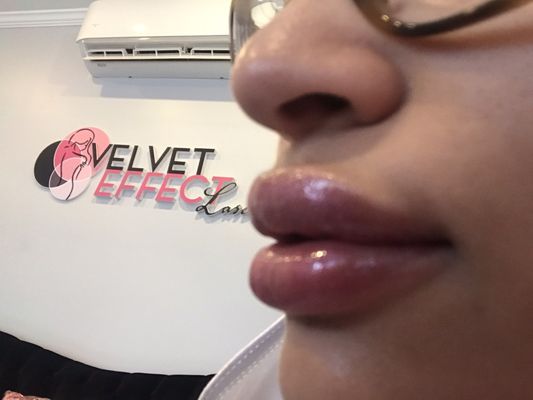 VELVET EFFECT LASERS - Updated August 2024 - 144 Photos & 100 Reviews ...