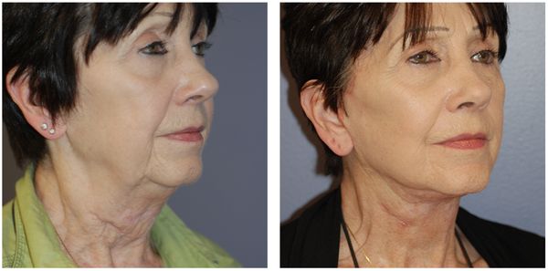 GINGER XU, MD - ETHOS PLASTIC SURGERY - Updated November 2025 - 39 ...