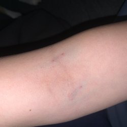 SUNSET RADIOLOGY - 20 Photos & 160 Reviews - 7000 SW 97th Ave, Miami ...