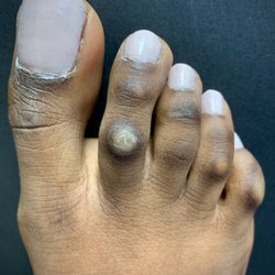 ABRAHAM WAGNER, DPM - JAWS PODIATRY - 32 Photos & 29 Reviews - 3700 ...