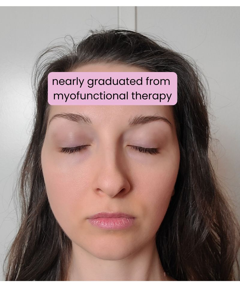 ORAL POSTURE OROFACIAL MYOFUNCTIONAL THERAPY - Updated January 2026 ...