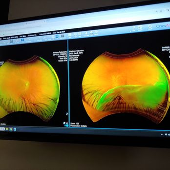 INVISION OPTOMETRY - Updated January 2025 - 58 Photos & 320 Reviews ...