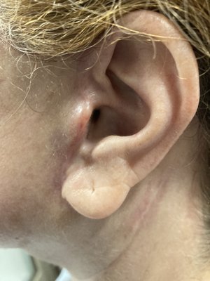 PHOENIX SKIN - Updated December 2025 - 37 Photos & 52 Reviews - 7312 E ...