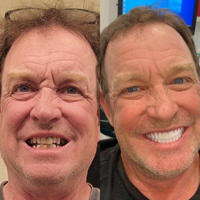 BIONIC SMILE - Updated September 2025 - 382 Photos & 13 Reviews - 4416 ...