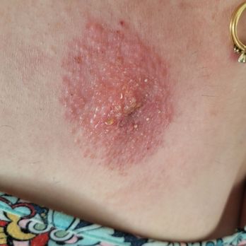 RADIOLOGY LTD - Updated August 2025 - 16 Photos & 83 Reviews - 677 N ...