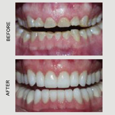 L. ANDREW MUTCH, DDS - Updated December 2025 - 22 Photos & 106 Reviews ...