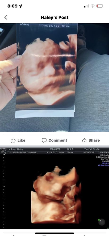 THE PINK GIRAFFE 4D ELECTIVE ULTRASOUNDS - Updated July 2025 - 21 ...