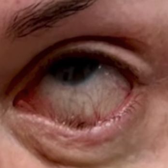 GUY MASSRY, MD - Updated October 2025 - 154 Photos & 172 Reviews - 150 ...