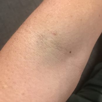 LABCORP - Updated February 2025 - 18 Photos & 45 Reviews - 1401 Avocado ...