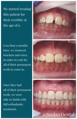 BUZBEE DENTAL - Updated June 2026 - 25 Photos & 10 Reviews - 1244 E ...